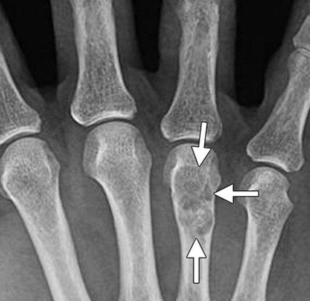 Dr. Manit K. Gundavda - Consultant, Orthopaedic Oncology